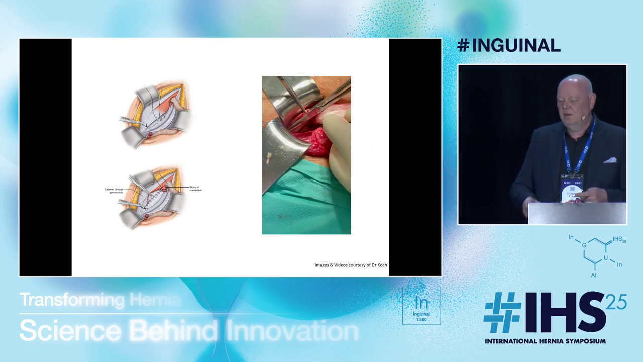 #IHS25 Dr. Koch Tailored Approach in Open Inguinal Hernia Surgery BD ...